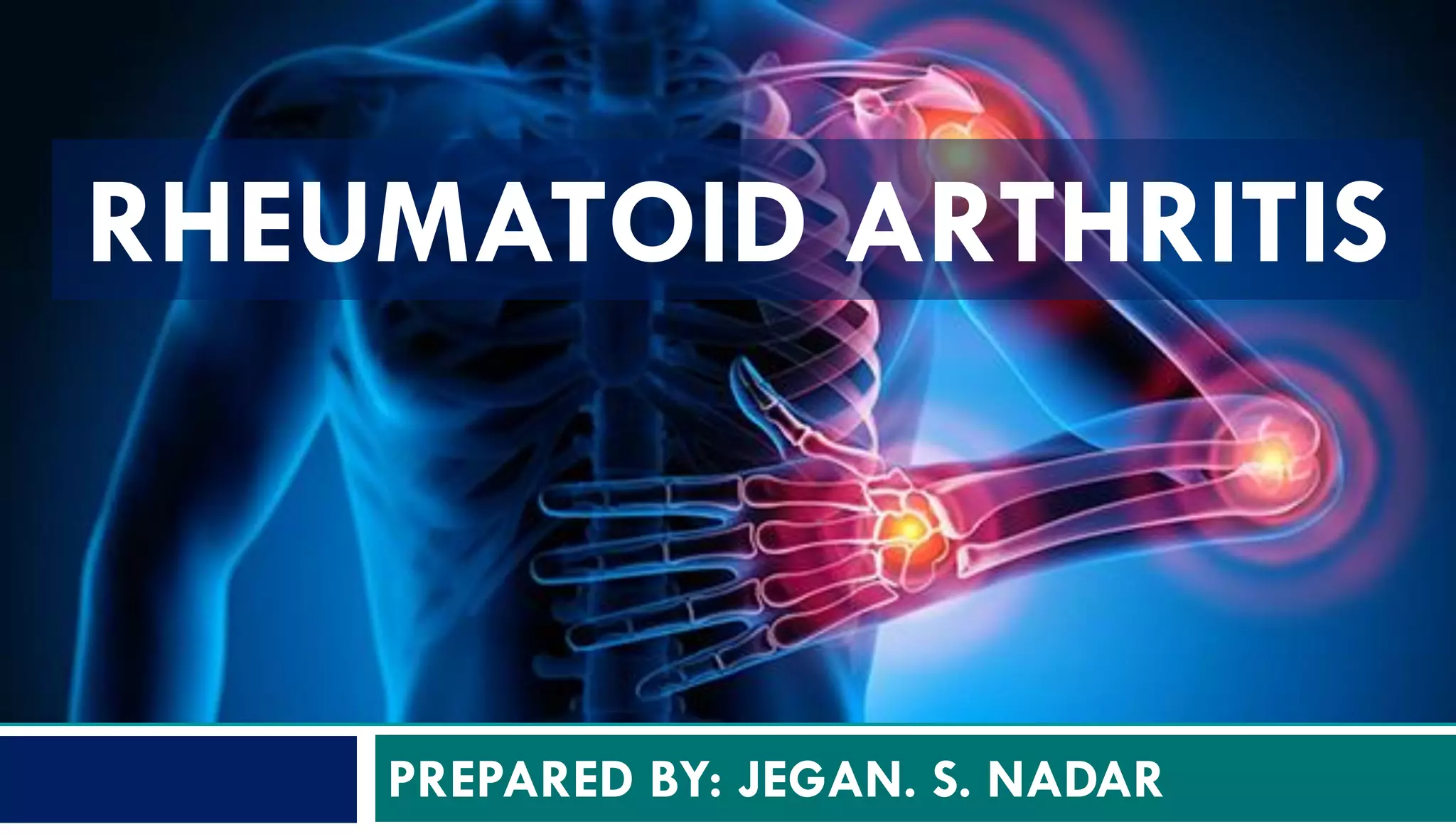 Pathophysiology of Rheumatoid arthritis | PDF