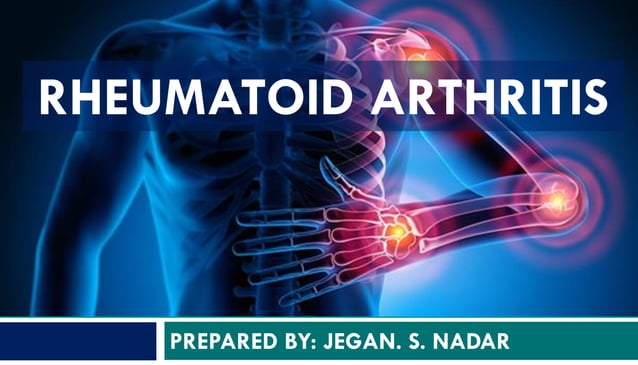 Pathophysiology of Rheumatoid arthritis | PDF | Bone and Joint ...