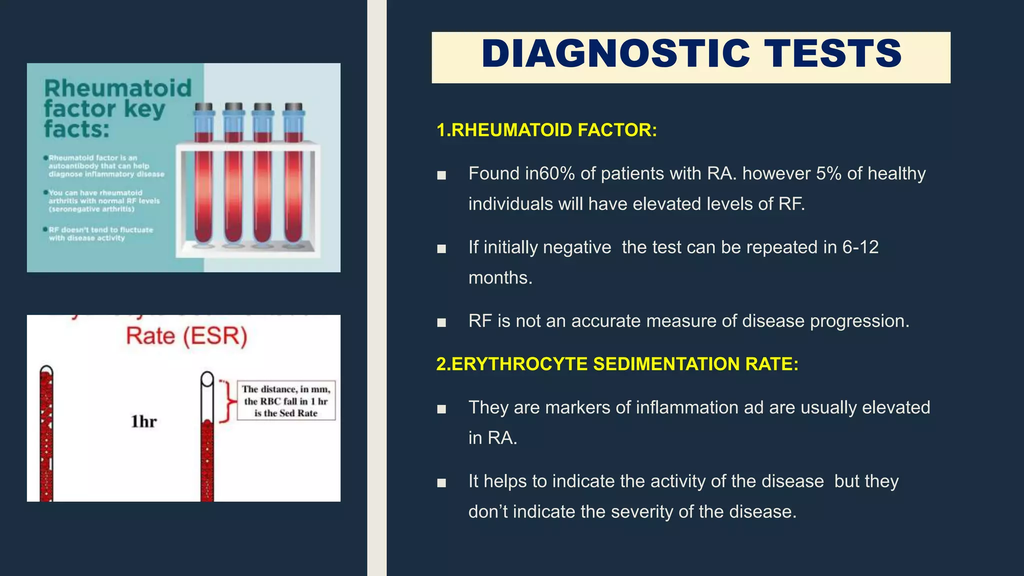 Rheumatoid arthritis | PPTX