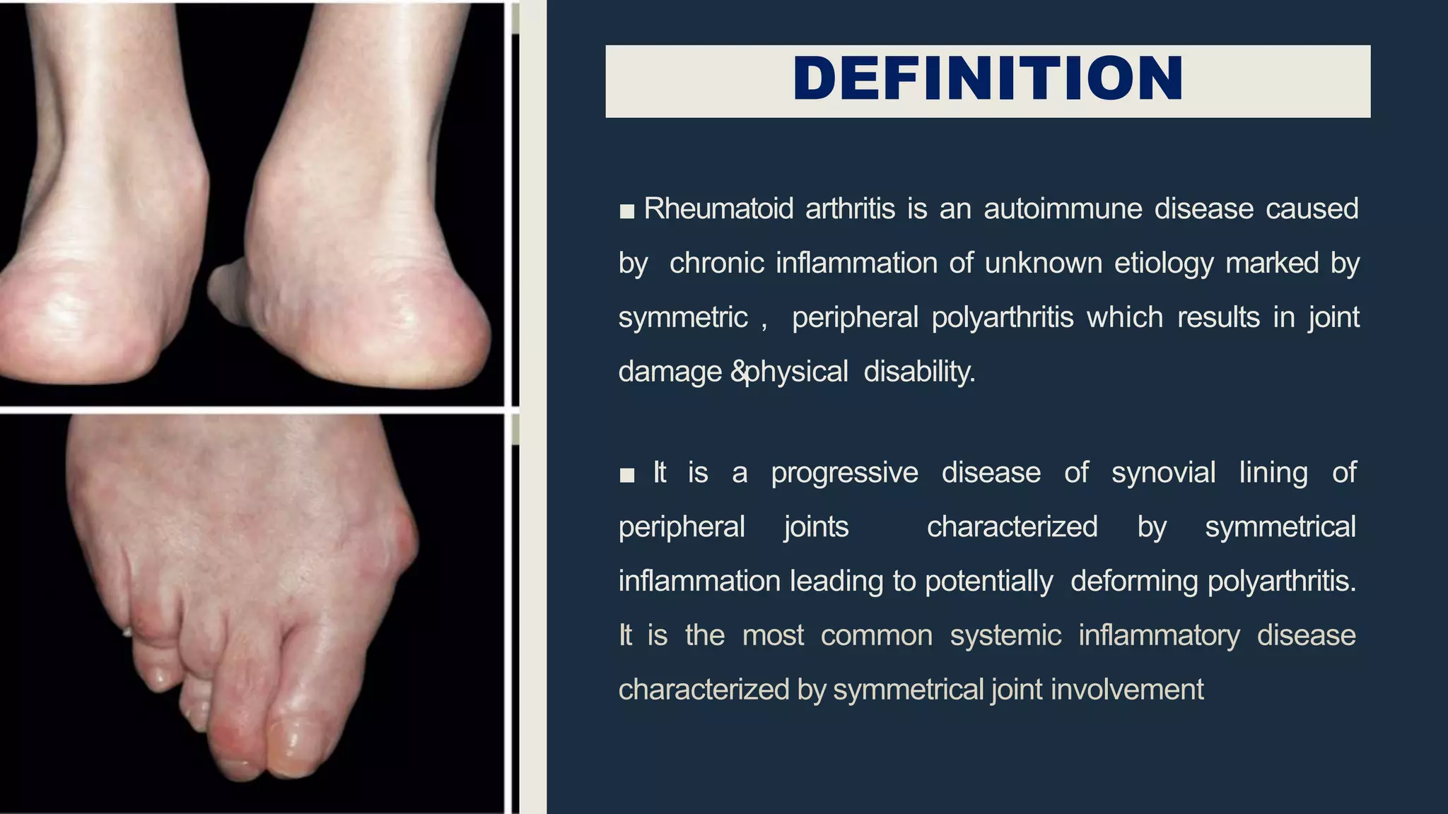Rheumatoid arthritis | PPTX