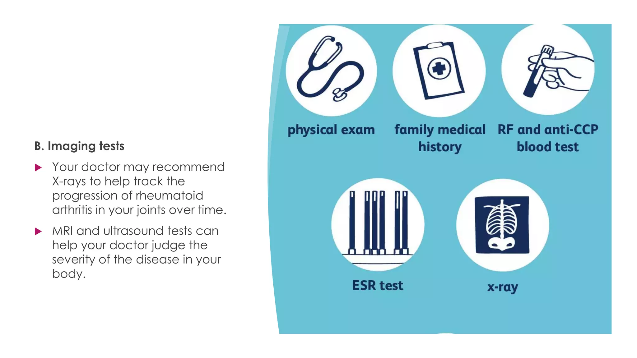 Rheumatoid arthritis- diagnosis and treatment | PDF