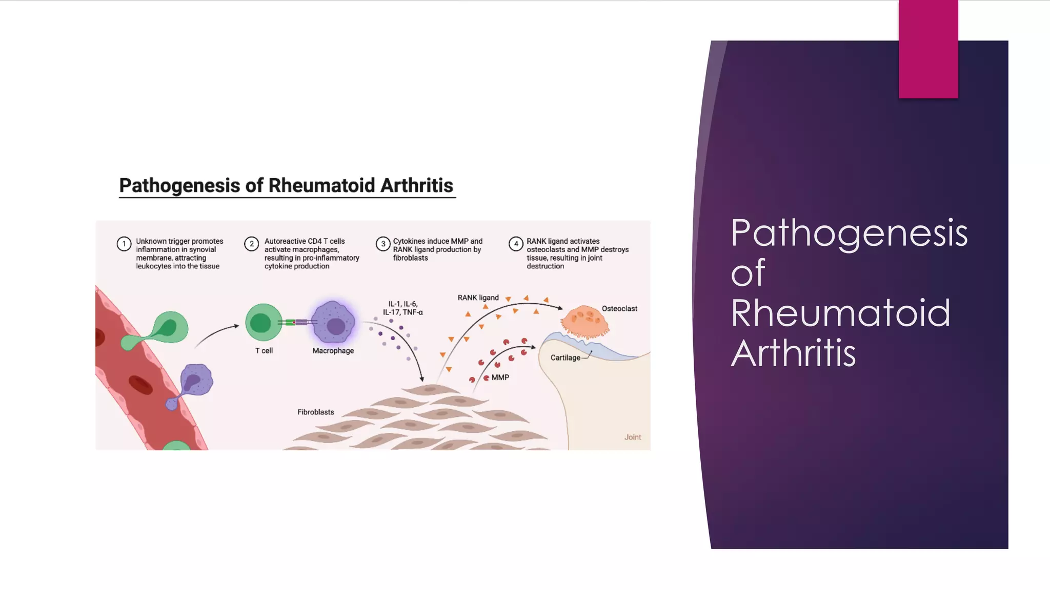 Rheumatoid arthritis- diagnosis and treatment | PDF
