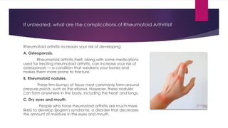 Rheumatoid arthritis- diagnosis and treatment | PDF
