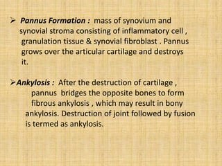 Rheumatoid Arthritis.pptx