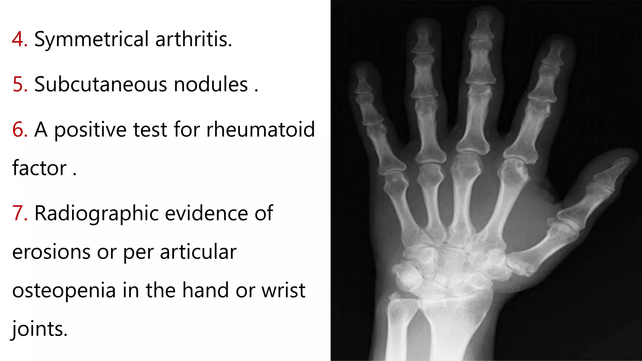 Rheumatoid arthritis.pptx