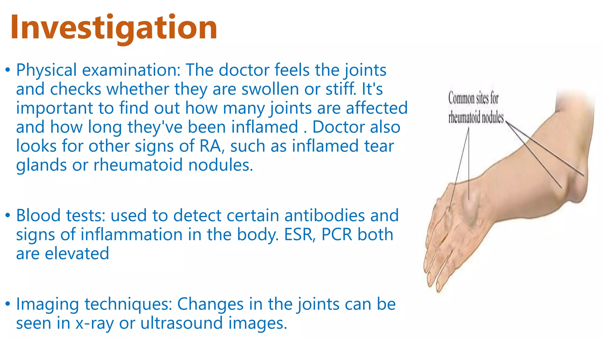 Rheumatoid arthritis.pptx