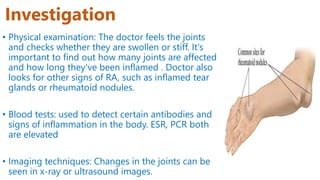 Rheumatoid arthritis.pptx