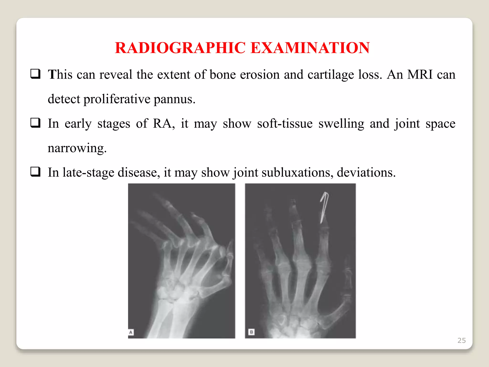 RHEUMATOID ARTHRITIS.pptx