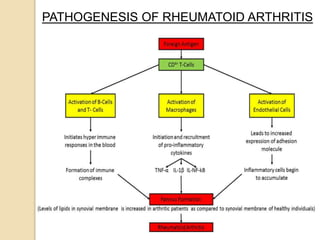 RHEUMATOID ARTHRITIS | PPTX