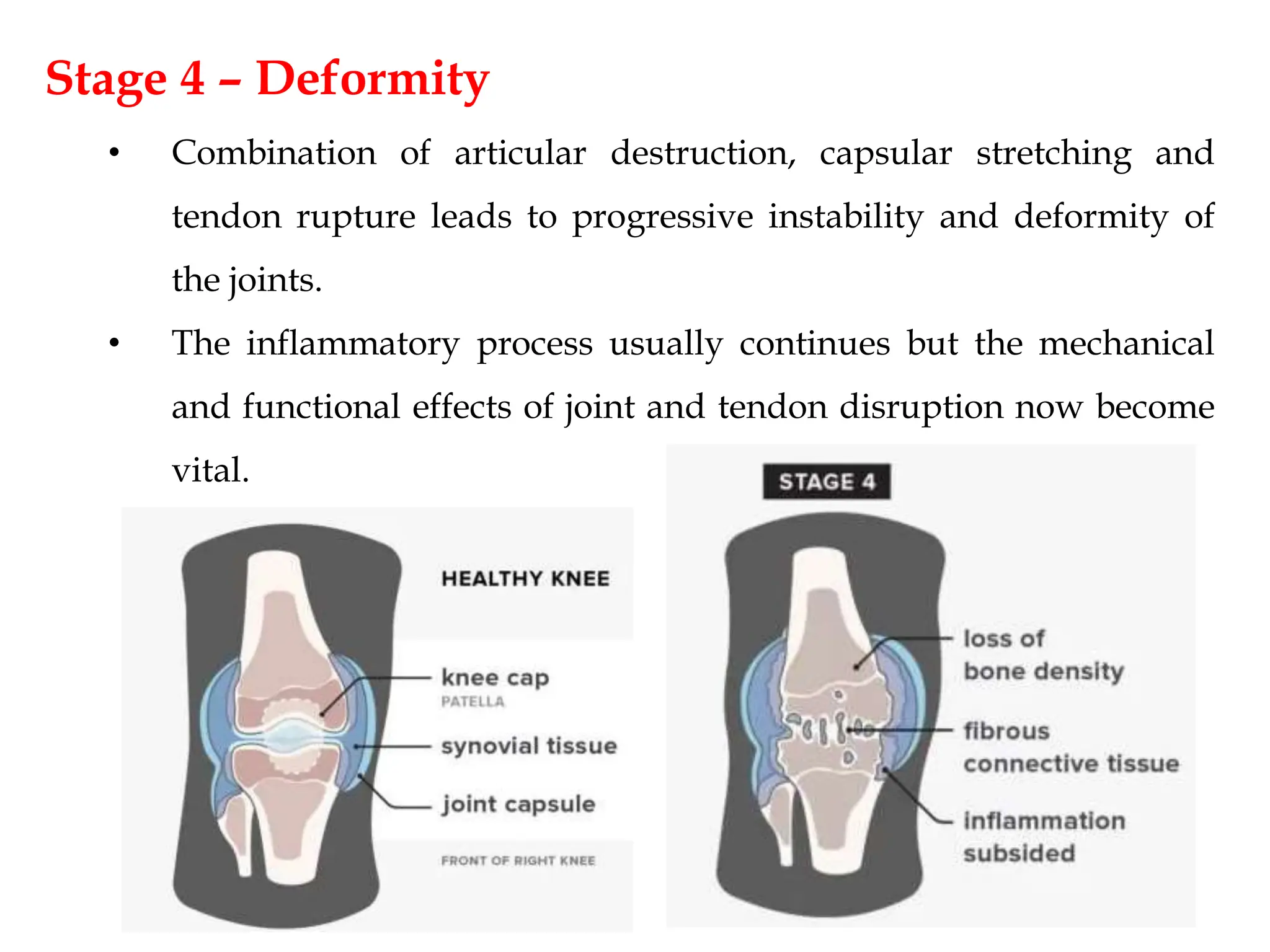 Clinical Pharmacotherapy of Rheumatoid Arthritis | PPTX