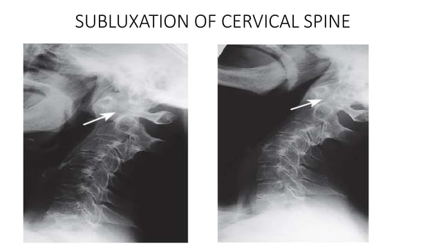 RHEUMATOID ARTHRITIS with dmards classification.pptx