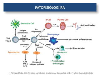 Rheumatoid Arthritis Diagnosis dan Manajemen Terapi | PPTX