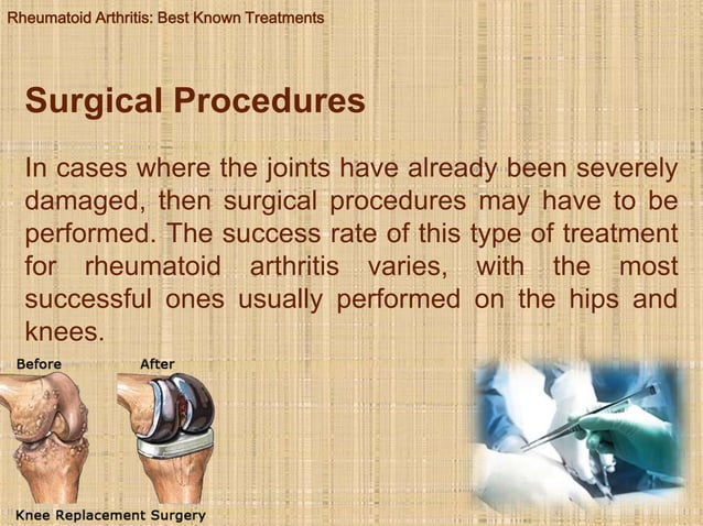 Rheumatoid Arthritis: Best Known Treatments | PPTX | Physical Therapy ...