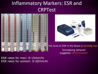 Rheumatoid arthritis -gihs | PPT