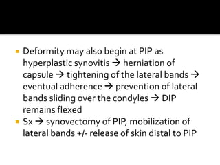 Rheumatoid arthritis hand | PPTX