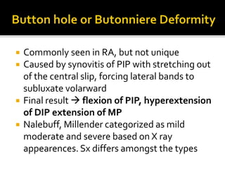 Rheumatoid arthritis hand | PPTX