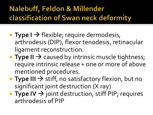 Rheumatoid arthritis hand