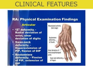 Rheumatoid Arthritis (2).pptx an approach to management | PPT
