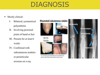 Rheumatoid Arthritis (2).pptx an approach to management | PPTX