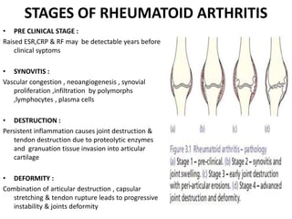 Rheumatoid arthritis | PPT