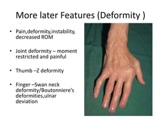 Rheumatoid arthritis | PPT