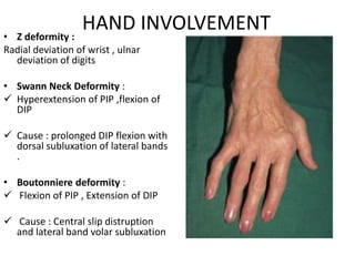 Rheumatoid arthritis | PPT