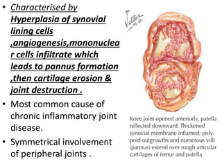 Rheumatoid arthritis | PPT