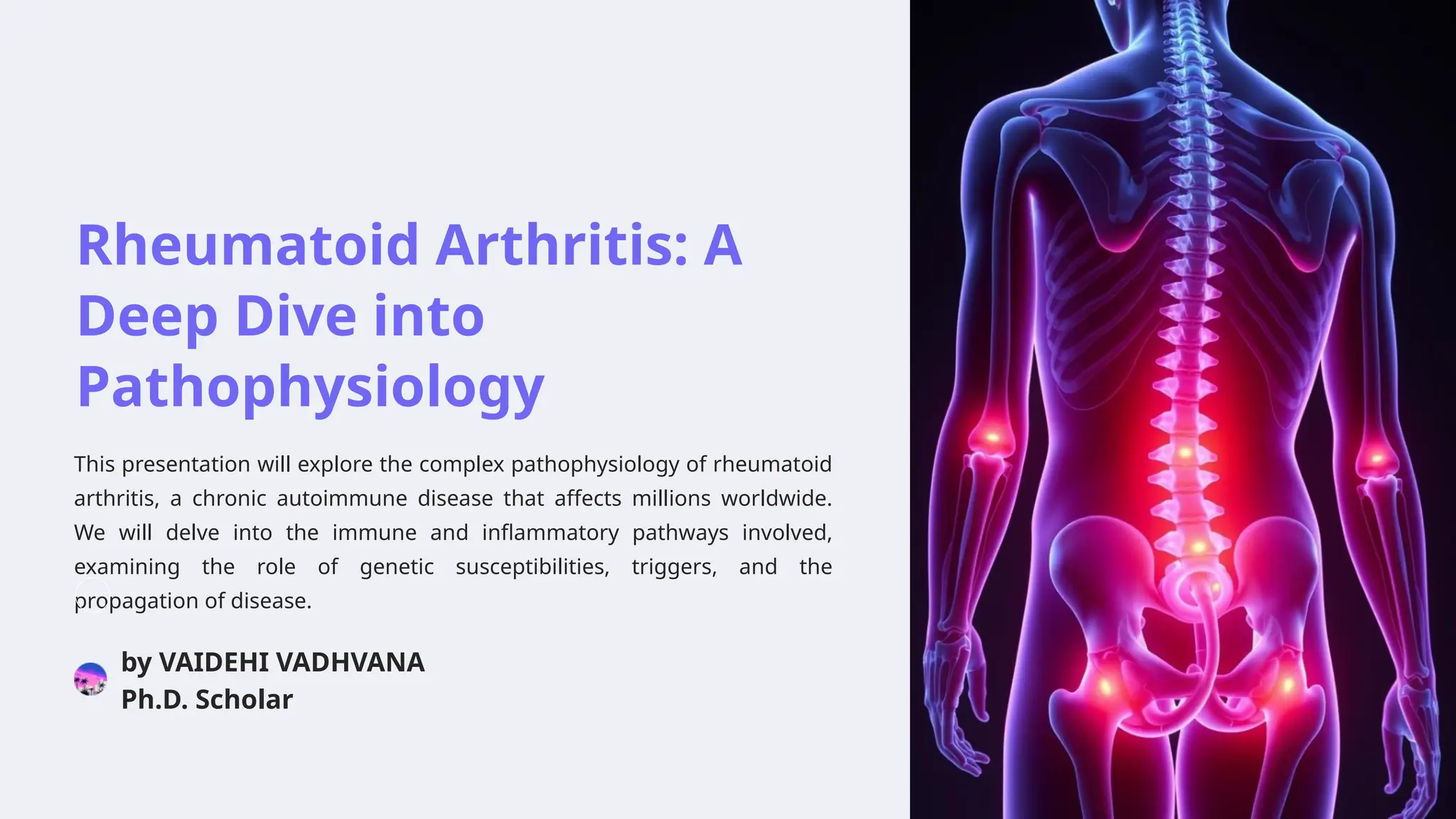 Rheumatoid Arthritis: A Deep Dive into Pathophysiology | PPT