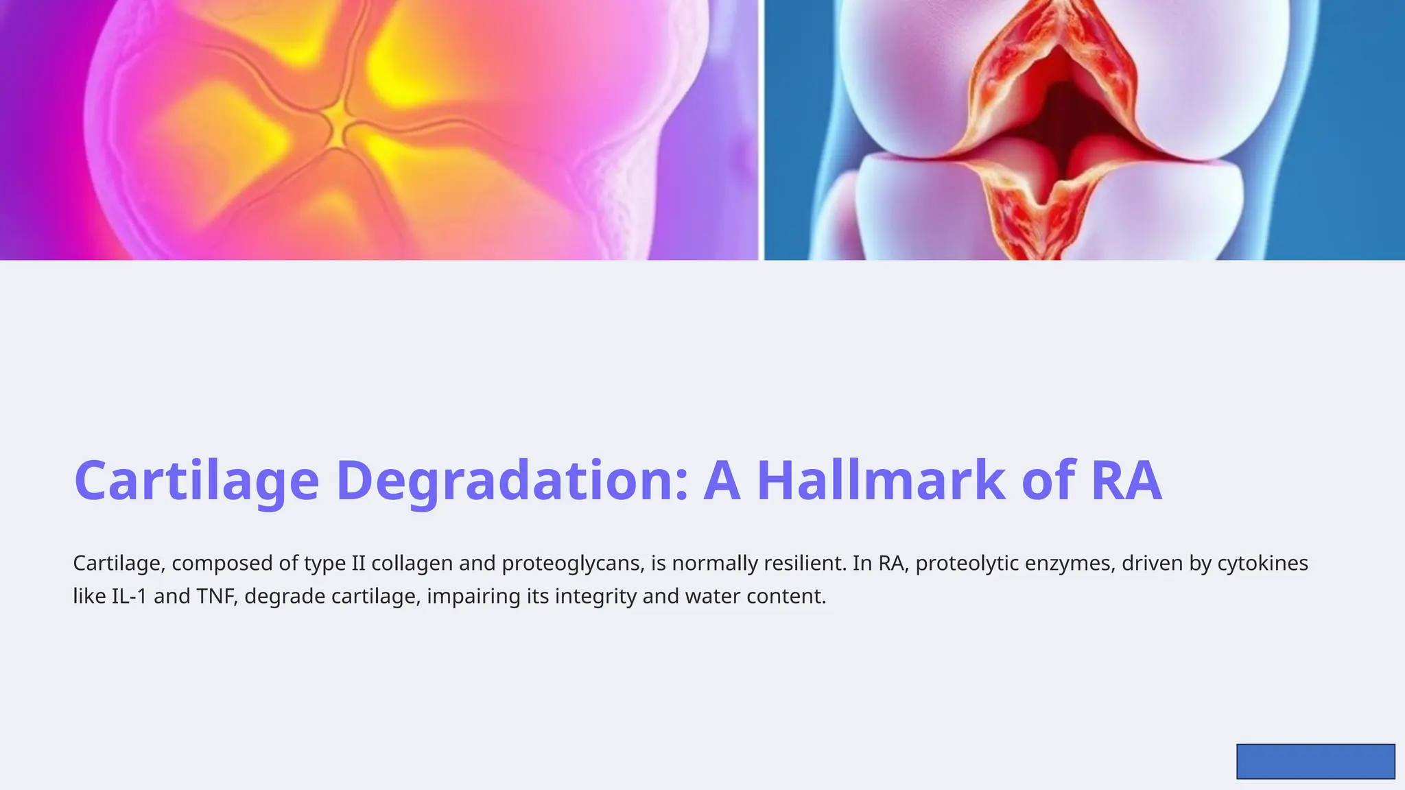 Rheumatoid Arthritis: A Deep Dive into Pathophysiology | PPT