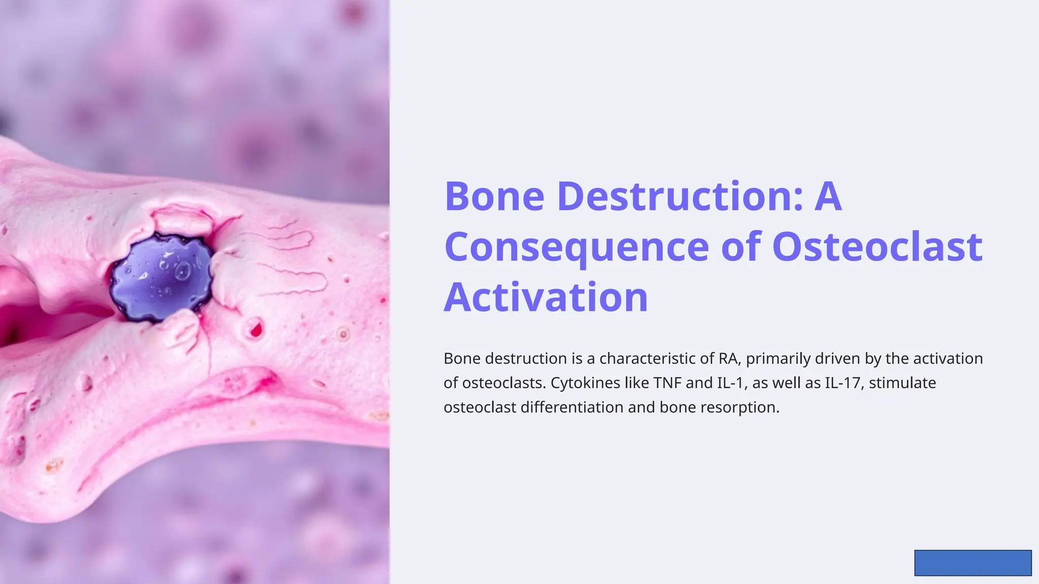Rheumatoid Arthritis: A Deep Dive into Pathophysiology | PPT