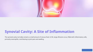 Rheumatoid Arthritis: A Deep Dive into Pathophysiology | PPT