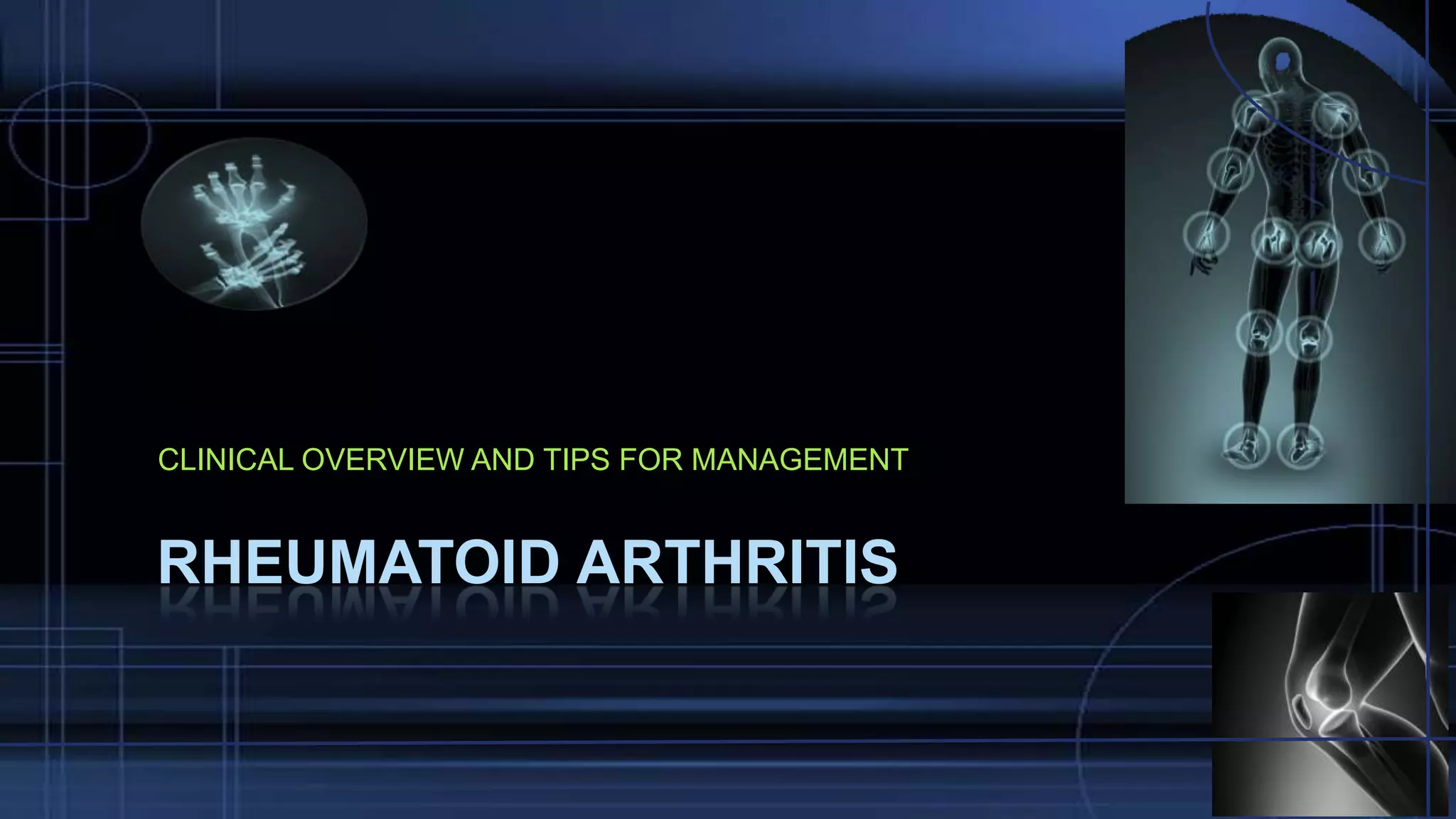 Rheumatoid arthritis clinical overview and tips for management | PPTX