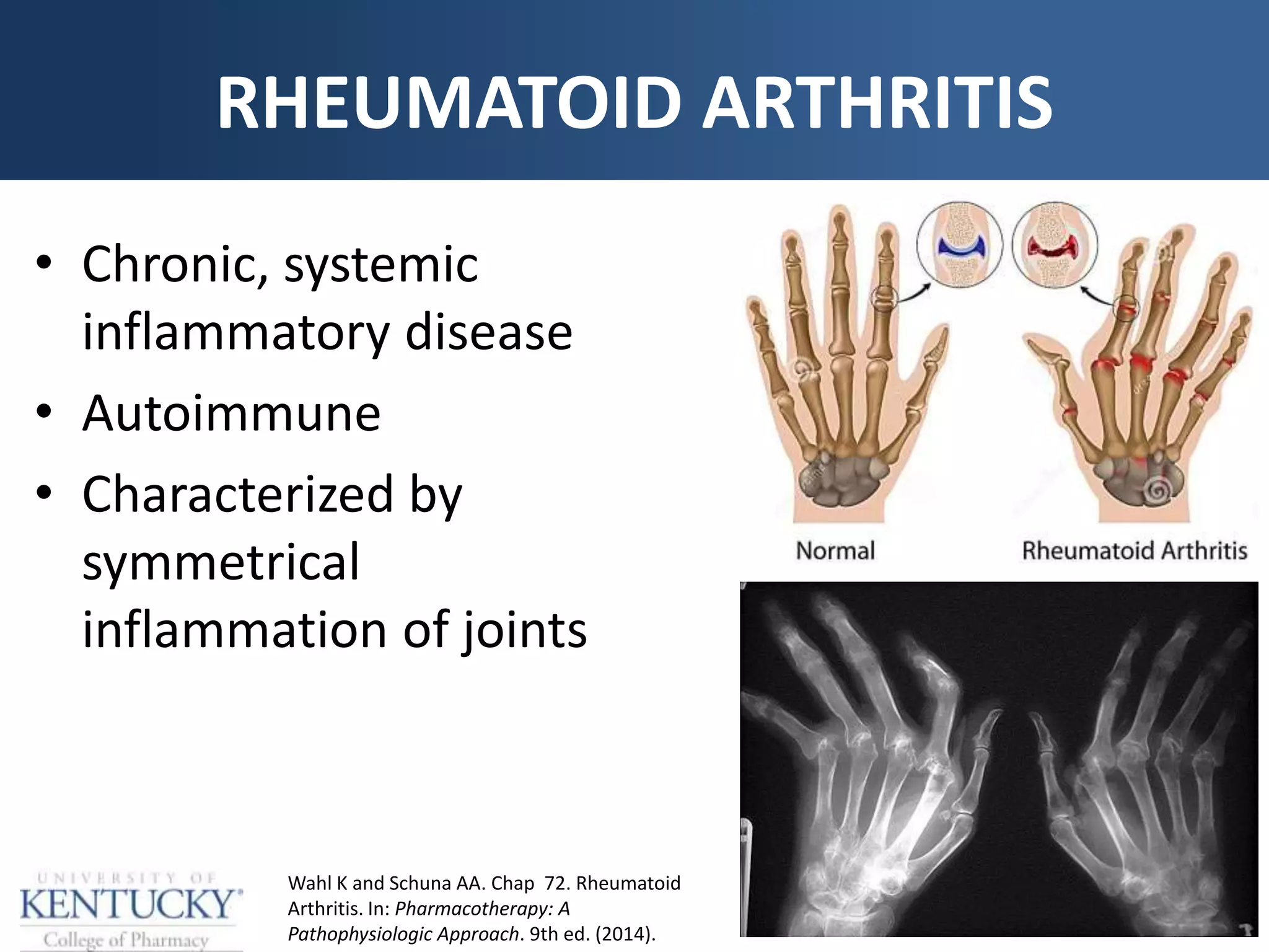 Rheumatoid Arthritis Lecture.ppt