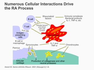 rheumatoid arthritis , pathogenesis, causes | PPTX