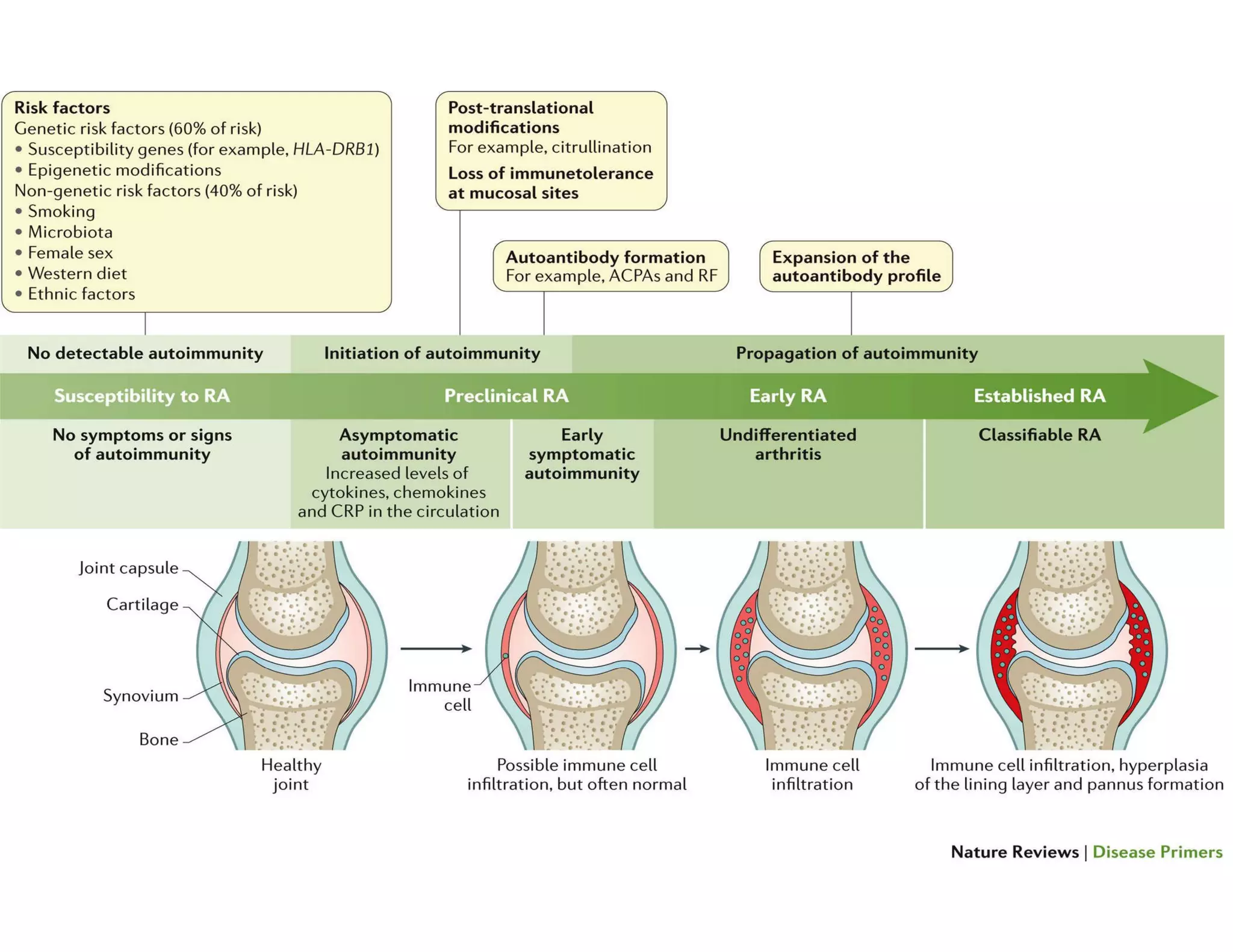 Rheumatoid arthritis pdf | PDF