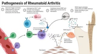 Rheumatoid Arthritis presentation ppt.pptx