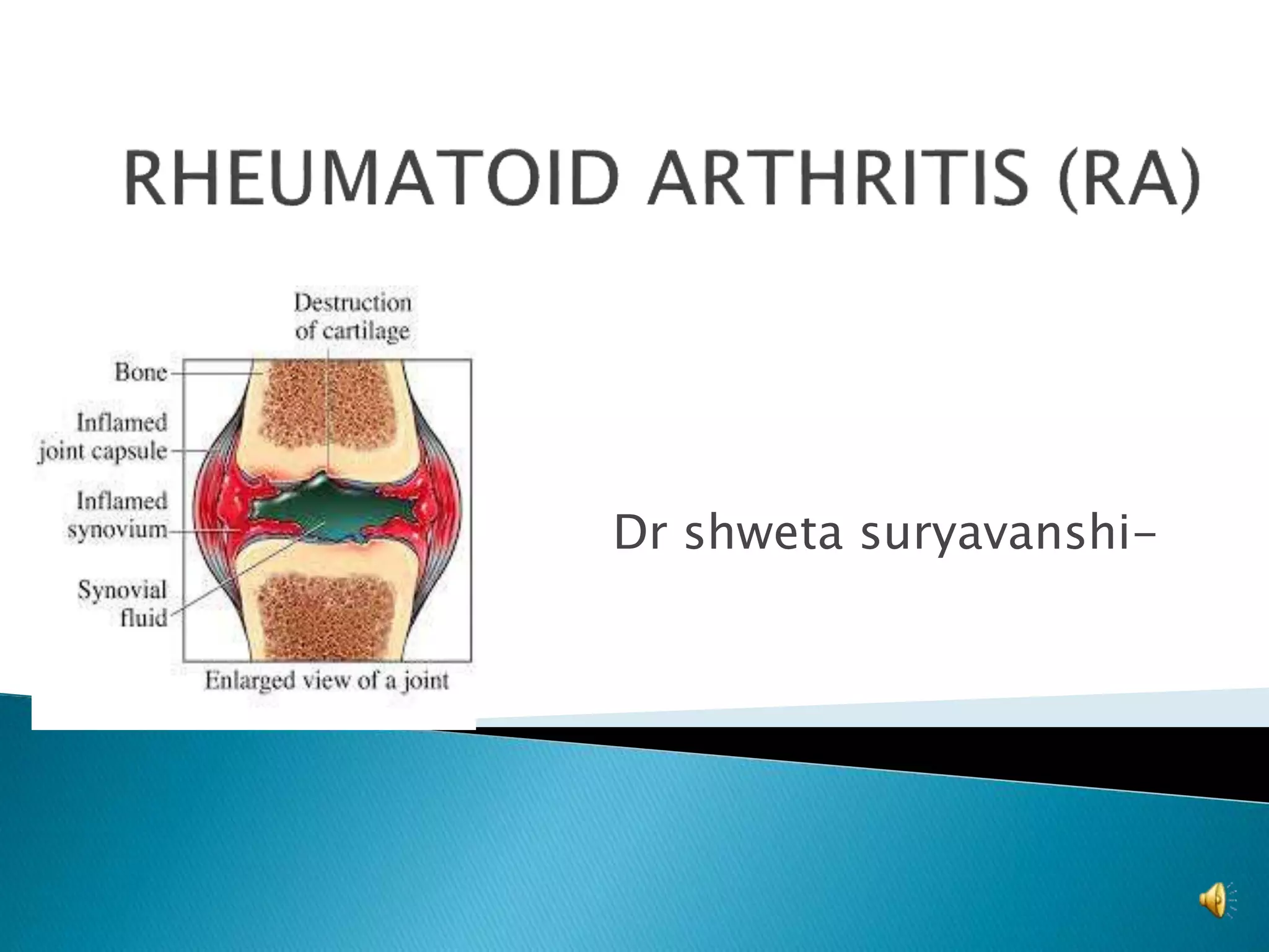 RHEUMATOID ARTHRITIS (RA).pptx