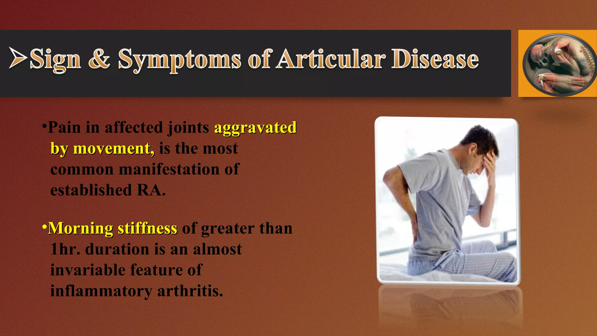 Rheumatoid arthritis with homoeopathy approach by Dr.Ankit Srivastav | PPS