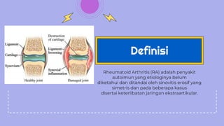 Rheumatoid Artritis, penjelasan, etiologi, epidemiologi sampe ...