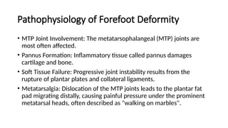 Rheumatoid Forefoot and Complex Reconstruction.pptx