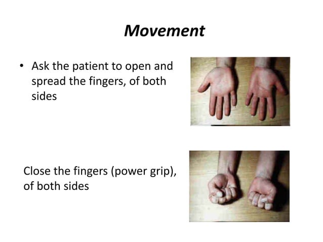 Rheumatological examination | PPTX
