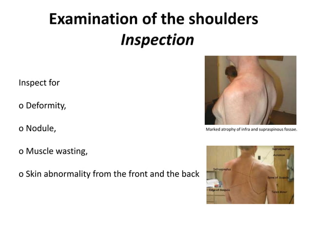 Rheumatological examination | PPTX