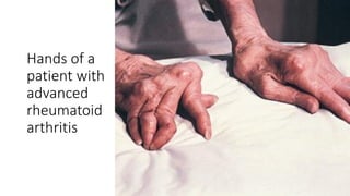 Rheumatologic and Connective tissue disorders | PDF