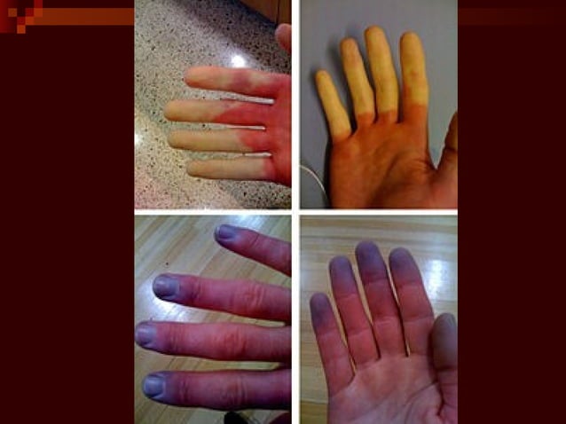 RHEUMATOLOGIC DISORDERS RHEUMATOLOGIC DISORDERS.ppt