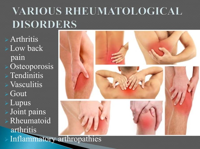 Austin Rheumatology | PPTX