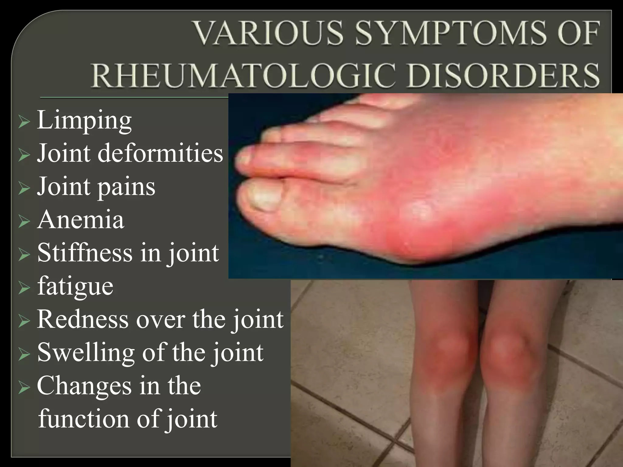 Austin Rheumatology | PPTX