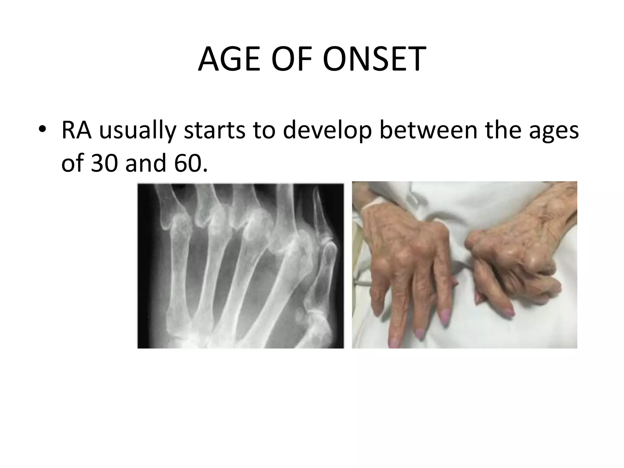RHEUMATOLOGY(2).pptx
