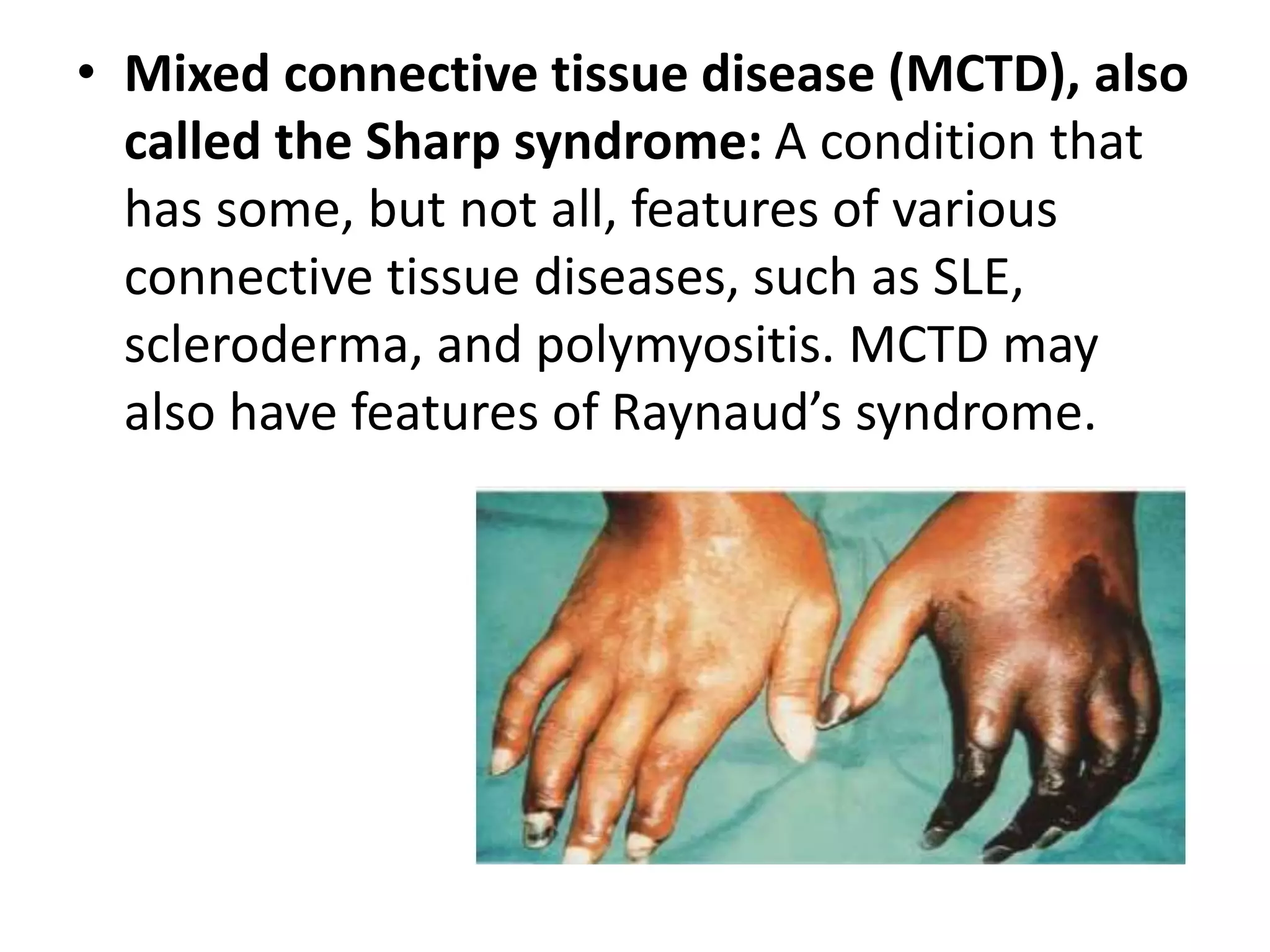 RHEUMATOLOGY(2).pptx | Bone and Joint Conditions | Diseases and Conditions