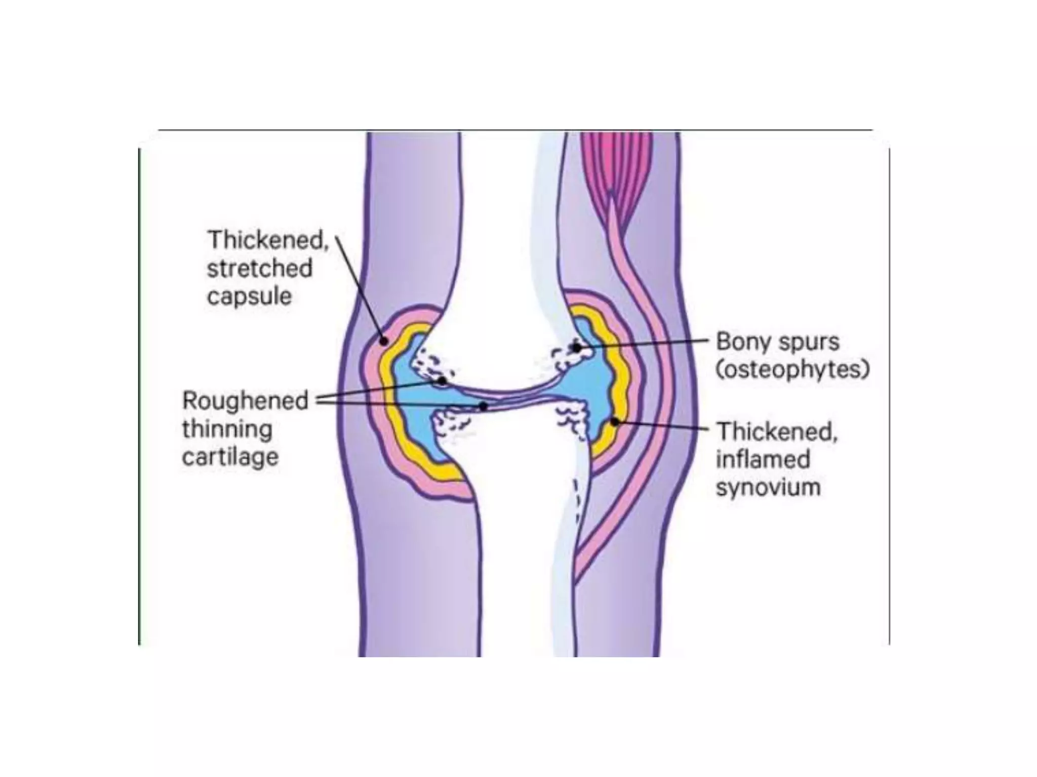 RHEUMATOLOGY(2).pptx