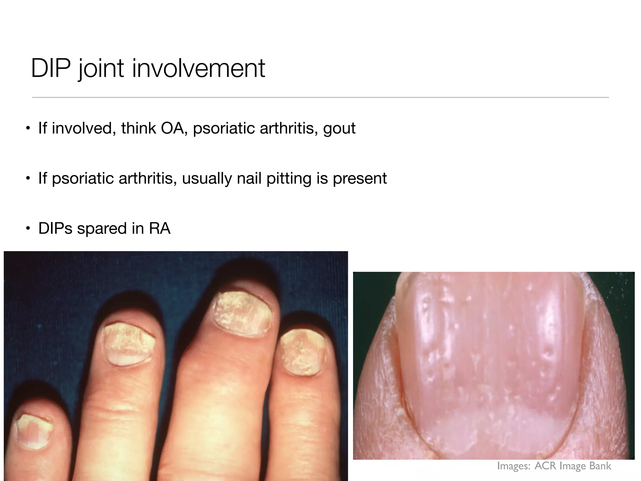 Rheumatology pearls 9-19-2014 | PDF